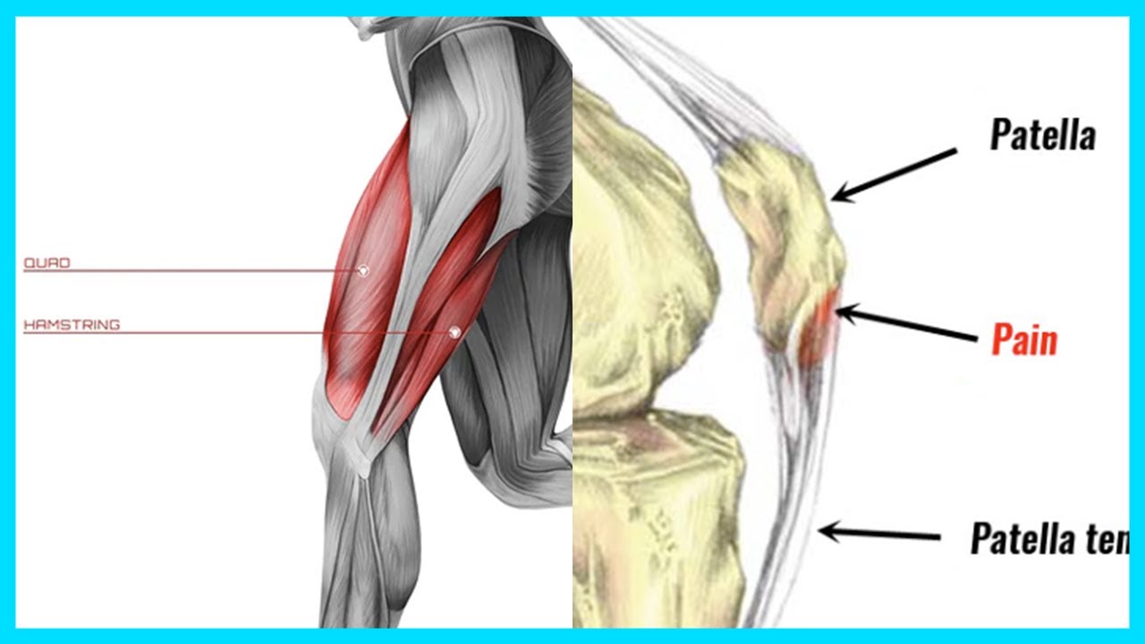 Overtraining Your MUSCLES Vs. Overtraining Tendons - YouTube