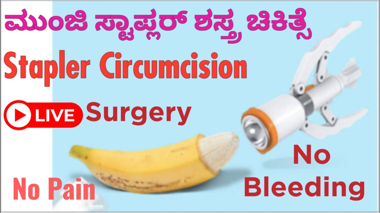 Stapler circumcision. ಸ್ಟಾಪಲರ್ ಶಸ್ತ್ರ ಚಿಕಿತ್ಸೆ. Dr C Sharath Kumar, Sexologist, Bangalore 10 ...