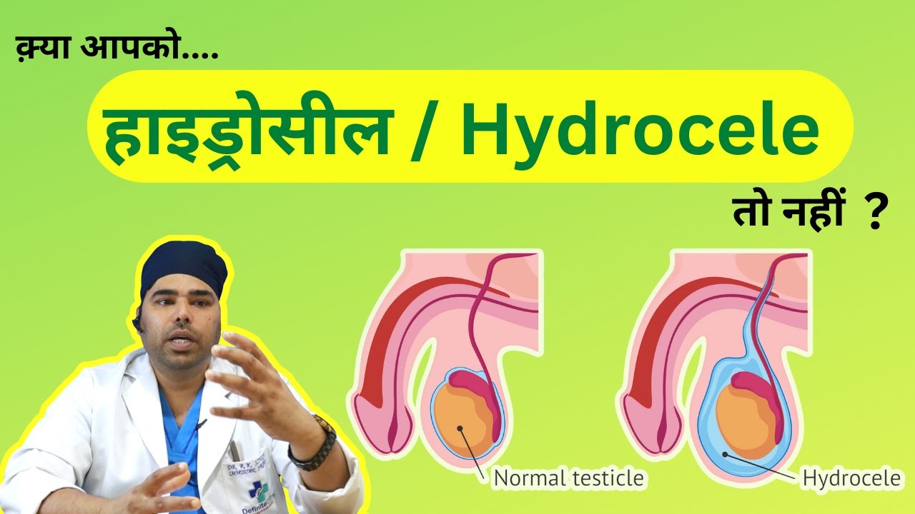 What is the main cause of hydrocele? - YouTube