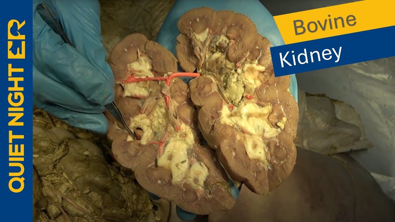 Veterinary Anatomy: Bovine Kidney - YouTube