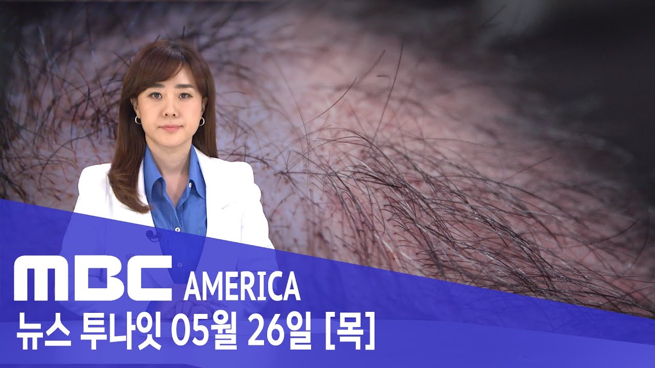 “모발 80% 다시 자라"...미국 신약 개발 성공? - MBC AMERICA (2022년 5월 26일) - YouTube