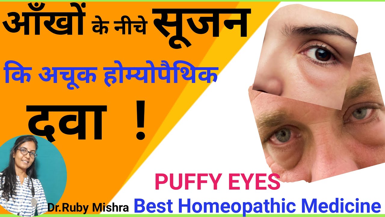 Homeopathic Medicine For Puffy Eyes homeopathic-medicine-for-puffy-eyes
