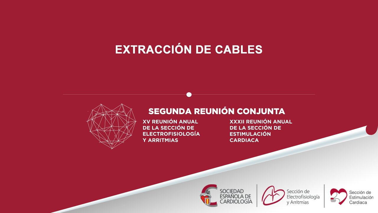 Extracción de cables - YouTube