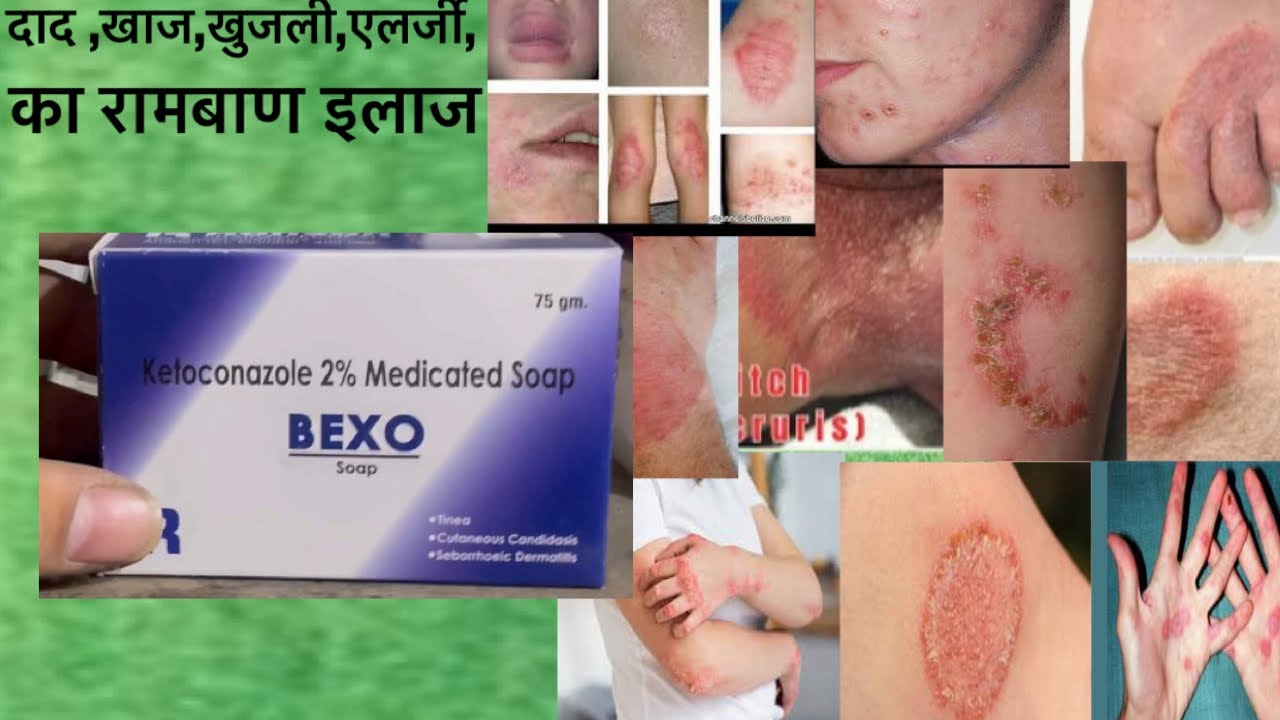 Bexo Tablet Full Information In Hindi | Uses | Side effects | Dosage ...