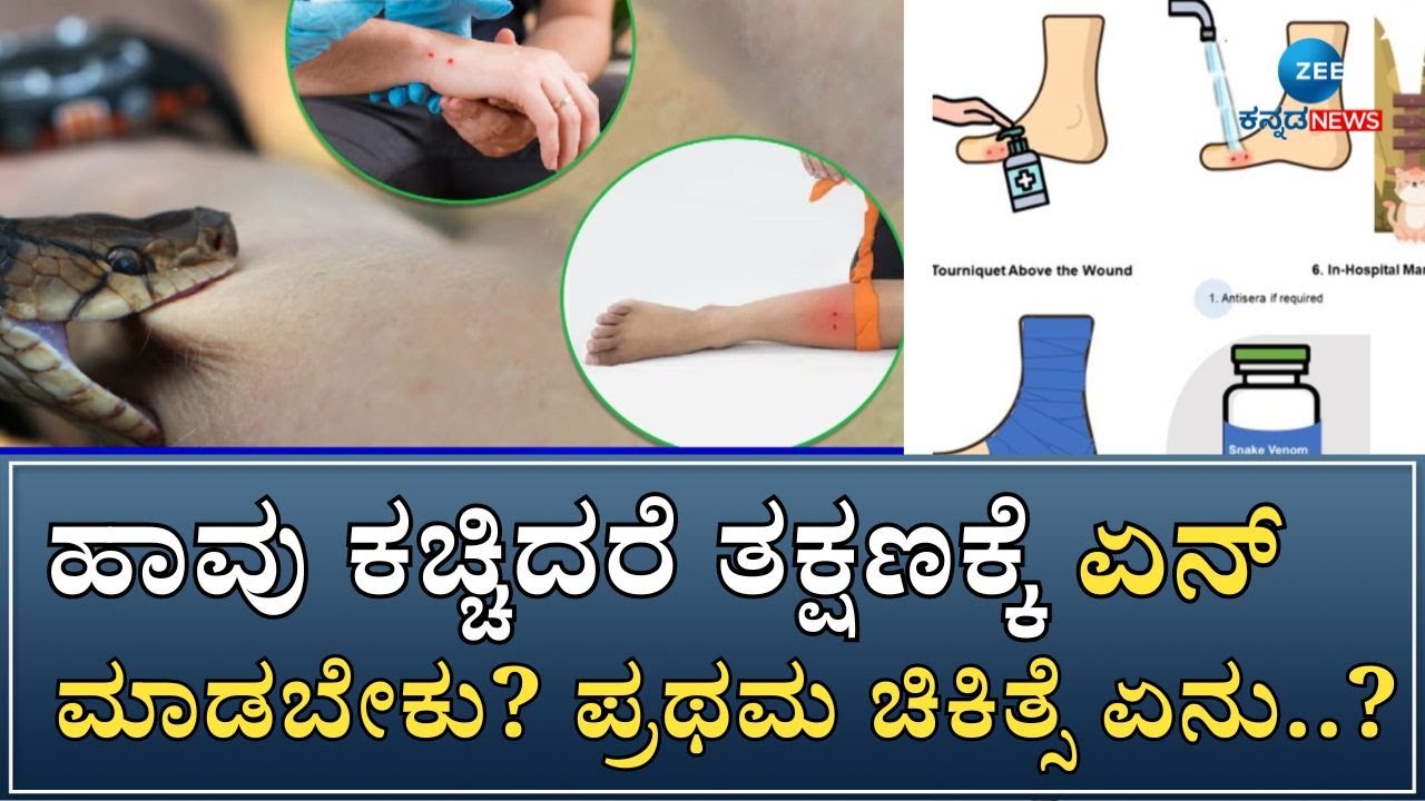 Snake Bite First Aid Treatment | ಉಸಿರು ನಿಲ್ಲಿಸುವ ಉರಗ ದಾಳಿಯ ಬಗ್ಗೆ ಈ ...