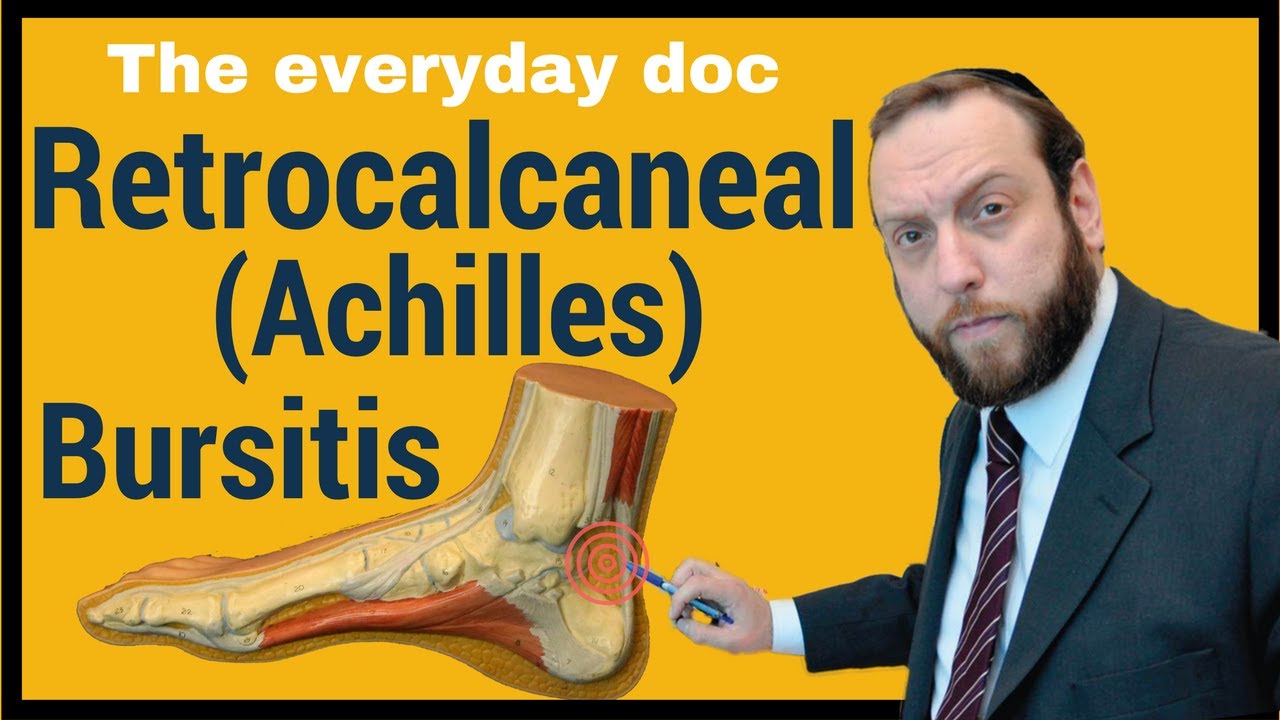 Retrocalcaneal bursitis or Achilles Bursitis - YouTube