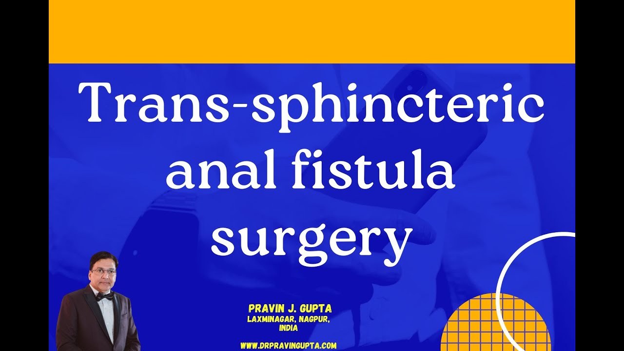COMPLEX ANAL FISTULA - TREATMENT OPTIONS - YouTube
