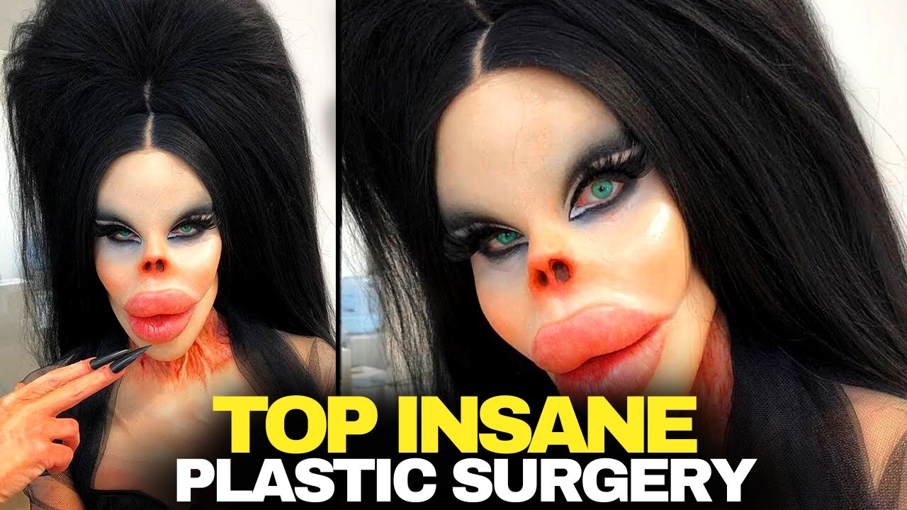 10 unusual people who took plastic surgery too far - YouTube