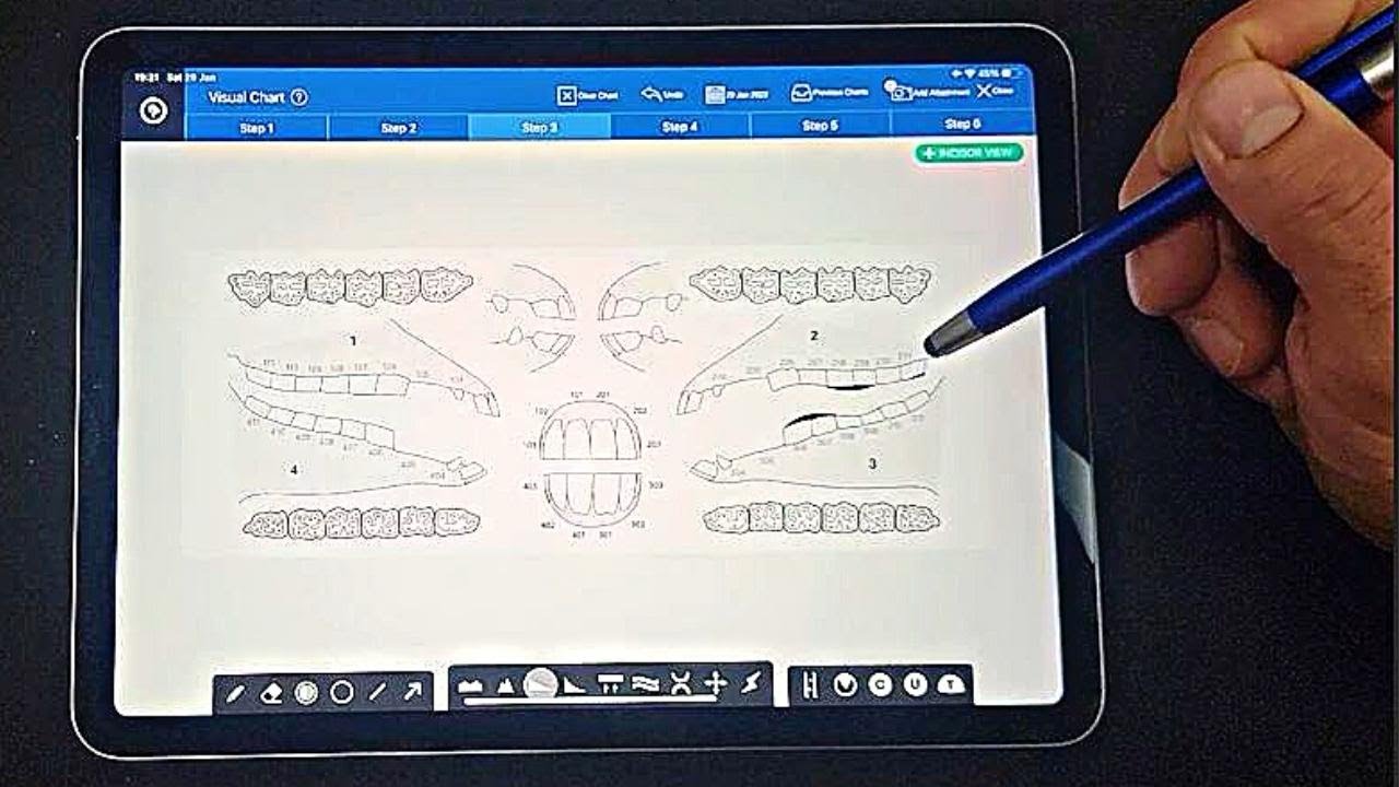Best equine dental software program - YouTube