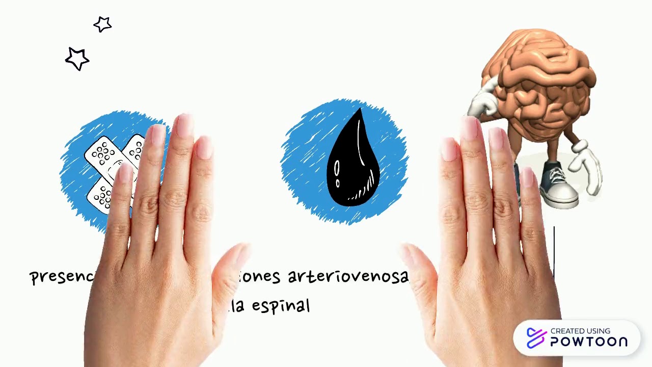 consideraciones via intratecal - YouTube