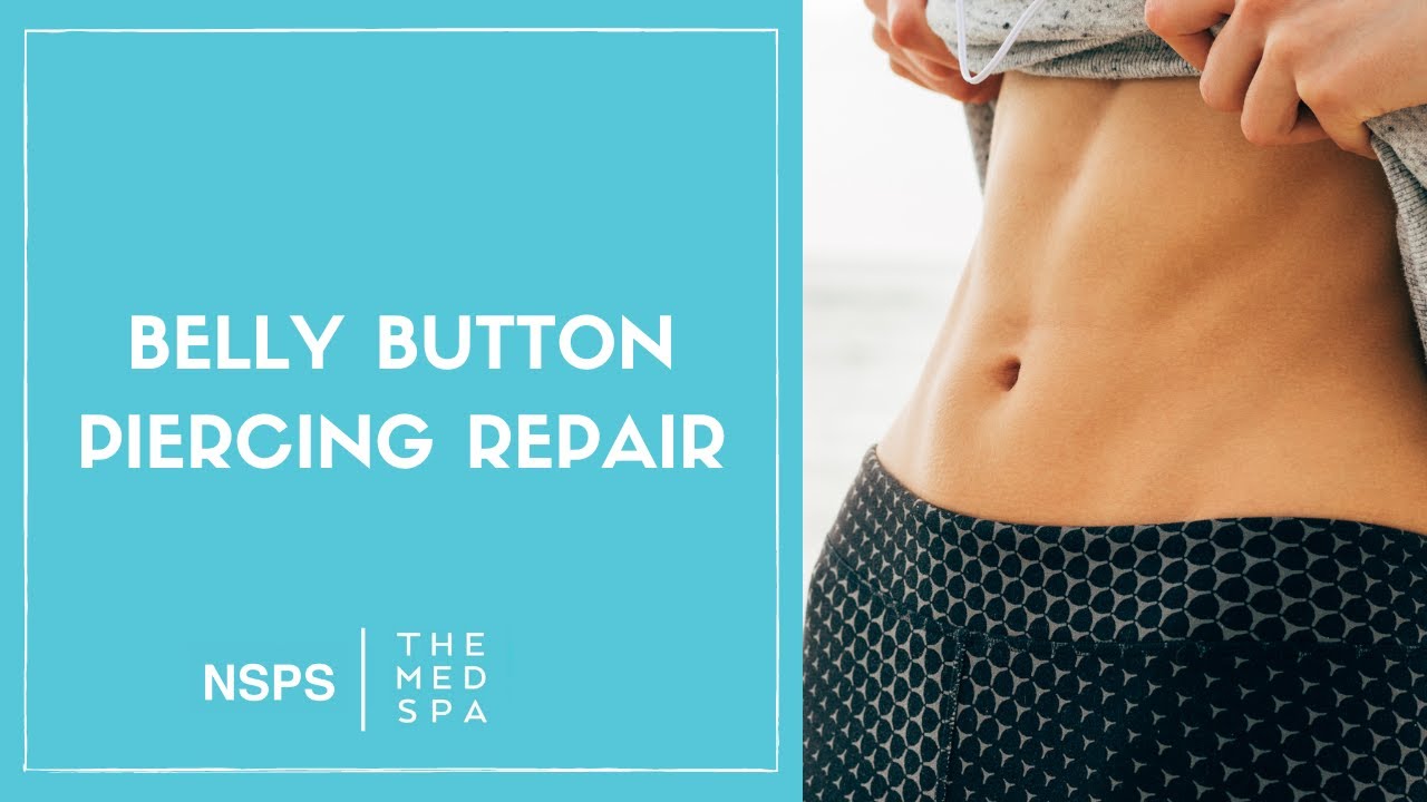 Belly Button Piercing Repair - YouTube