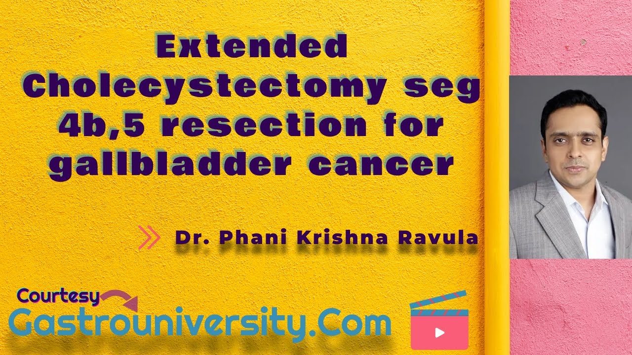 Gall Bladder-Extended Cholecystectomy seg 4b,5 resection for ...