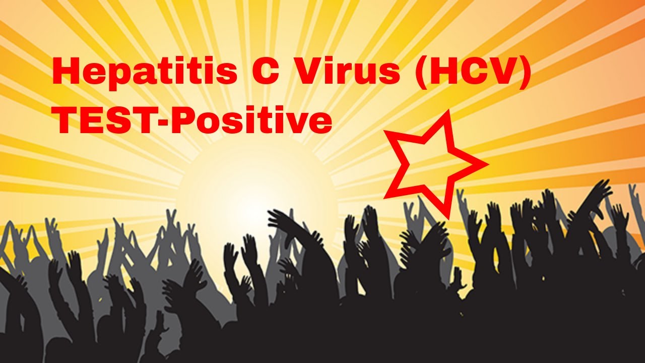 Hepatitis C virus Positive/HCV test -positive/HCV tri-dot POSITIVE ...