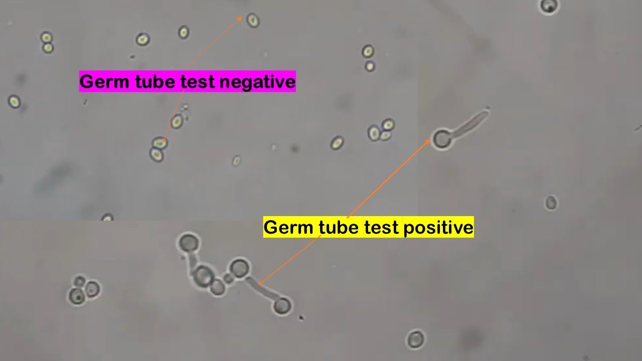 Germ tube test negative and positive Candida species demonstration ...