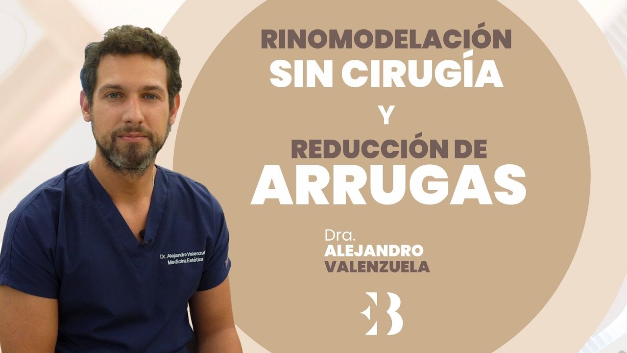 Rinomodelación y Tratamiento Antiarrugas Dr Alejandro Valenzuela - YouTube
