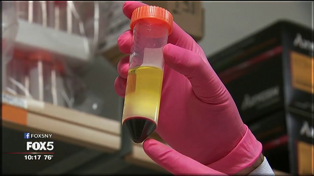 How a Liquid Biopsy Changes Cancer Treatment - YouTube