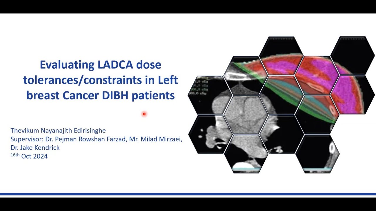 Thevikum Mudiyanselage: Evaluating LADCA dose tolerances/constraints in ...