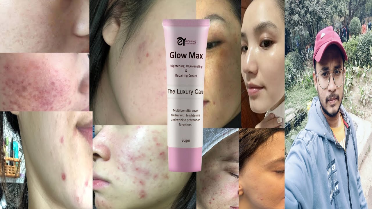 glow Max whitening & repairing cream | honest review - YouTube