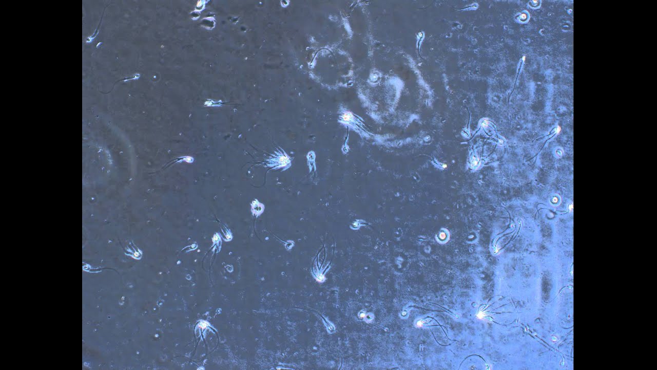 sperm aggregation Evo Bio - YouTube
