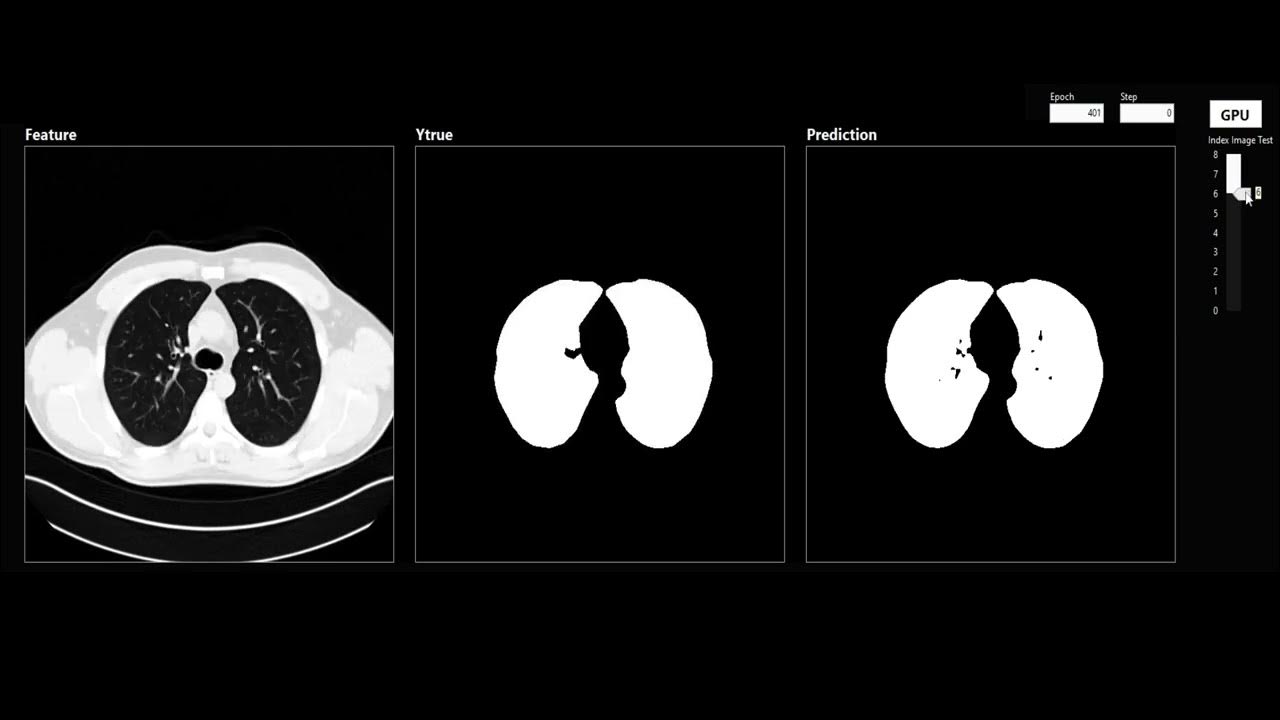 HAIBAL LabVIEW deep learning toolkit U-Net: Convolutional Networks for ...