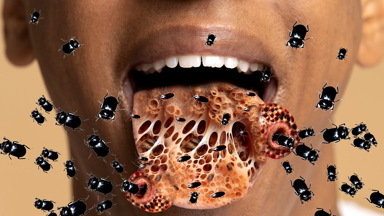 ASMR 2D Animation Treatment: Removing Maggots & Ticks from foot face ...