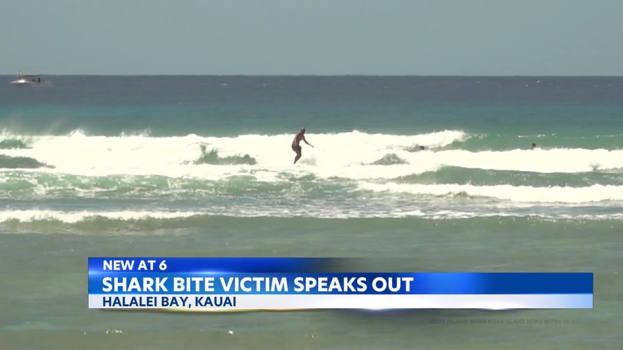 Surfer in Kauai's Hanalei Bay nearly loses leg in shark attack - YouTube