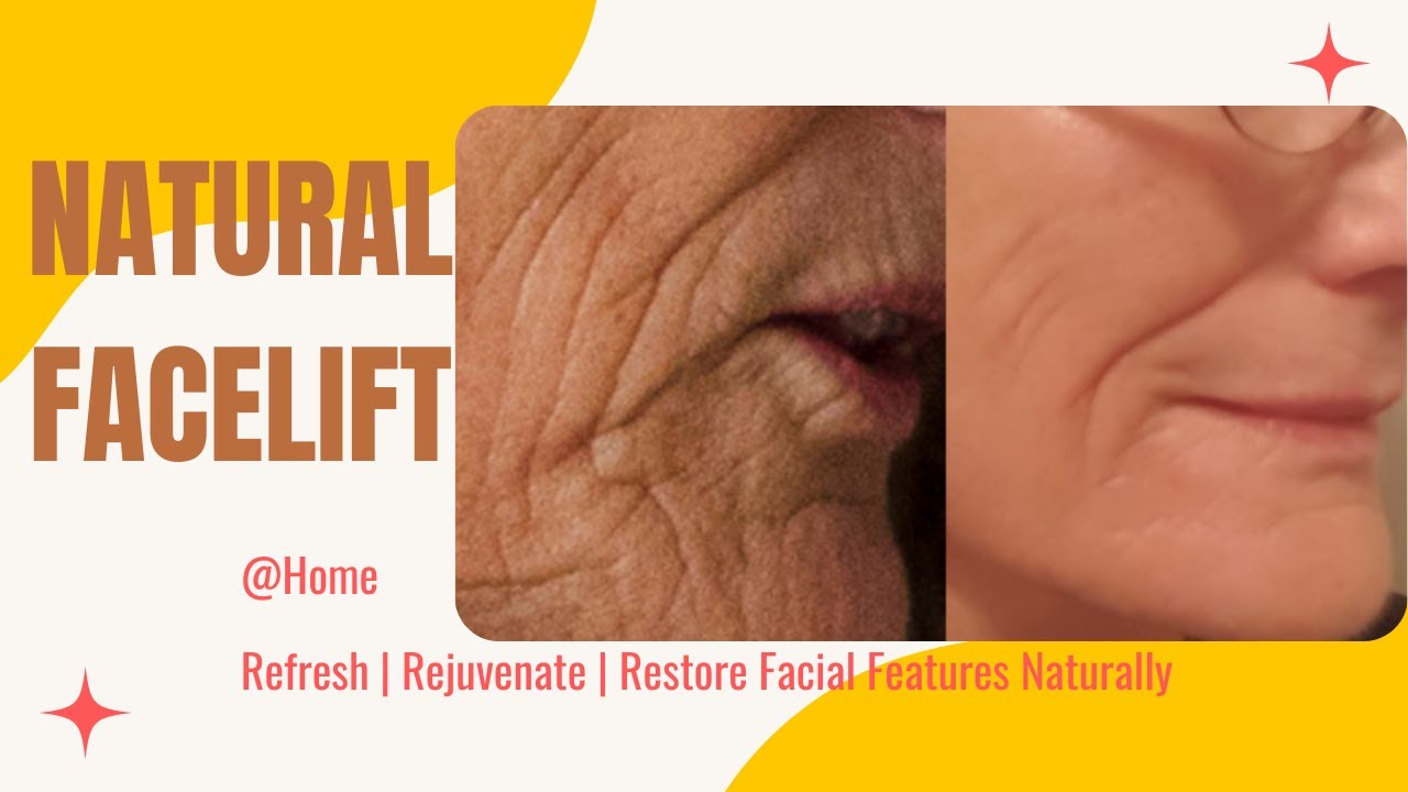 Creation of the Natural Facelift Method: The Benefits for Your Health ...