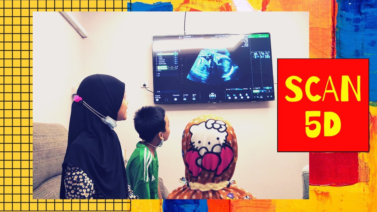 Detailed Scan Baby l 5D Scan - YouTube