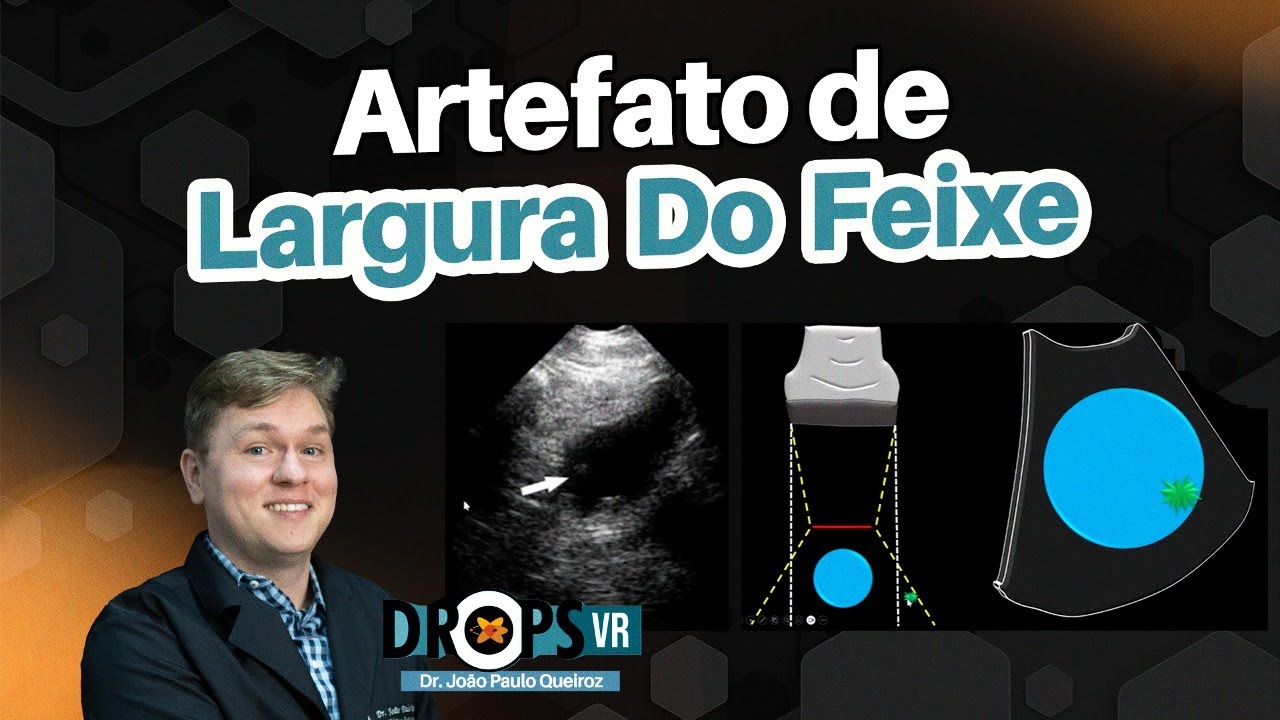 "IMAGEM FANTASMA" OU ARTEFATO DE LARGURA DO FEIXE: APRENDA COMO ...