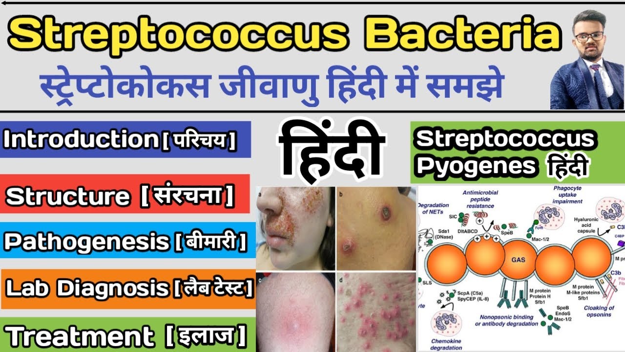 Streptococcus Pyogenes Bacteria | Streptococcus bacteria microbiology ...
