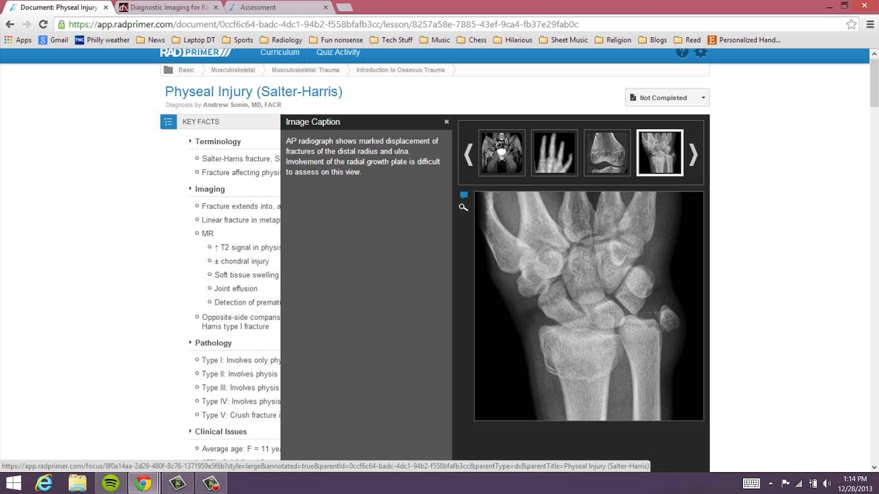 radprimer video 2 Screen Stream - YouTube