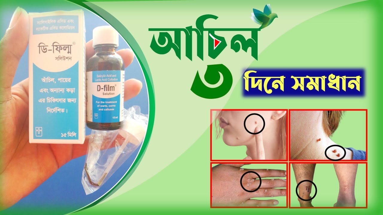 D Flim Solution | আঁচিল হলে কি করবেন জেনে নিন | আছিল এর চিকিৎসা - YouTube