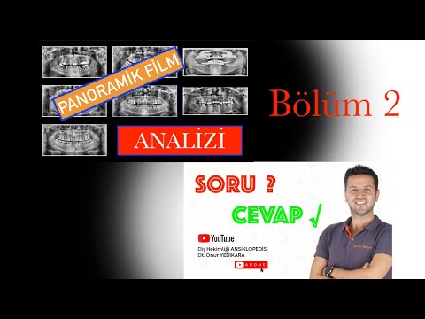 Panoramik Film Analizi - Soru Cevap ( Bölüm 2 )
