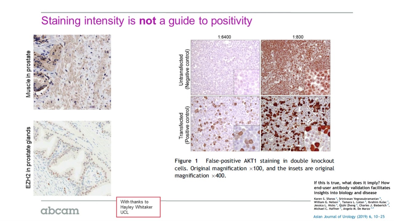 Validating antibodies for research applications in IHC - YouTube