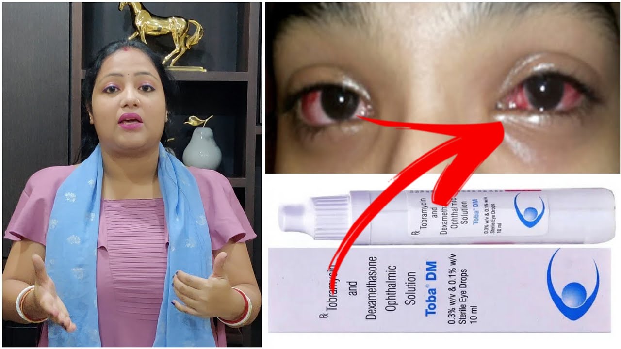 Conjunctivitis Medicine | Eye flue Treatment | Conjunctivitis Treatment ...