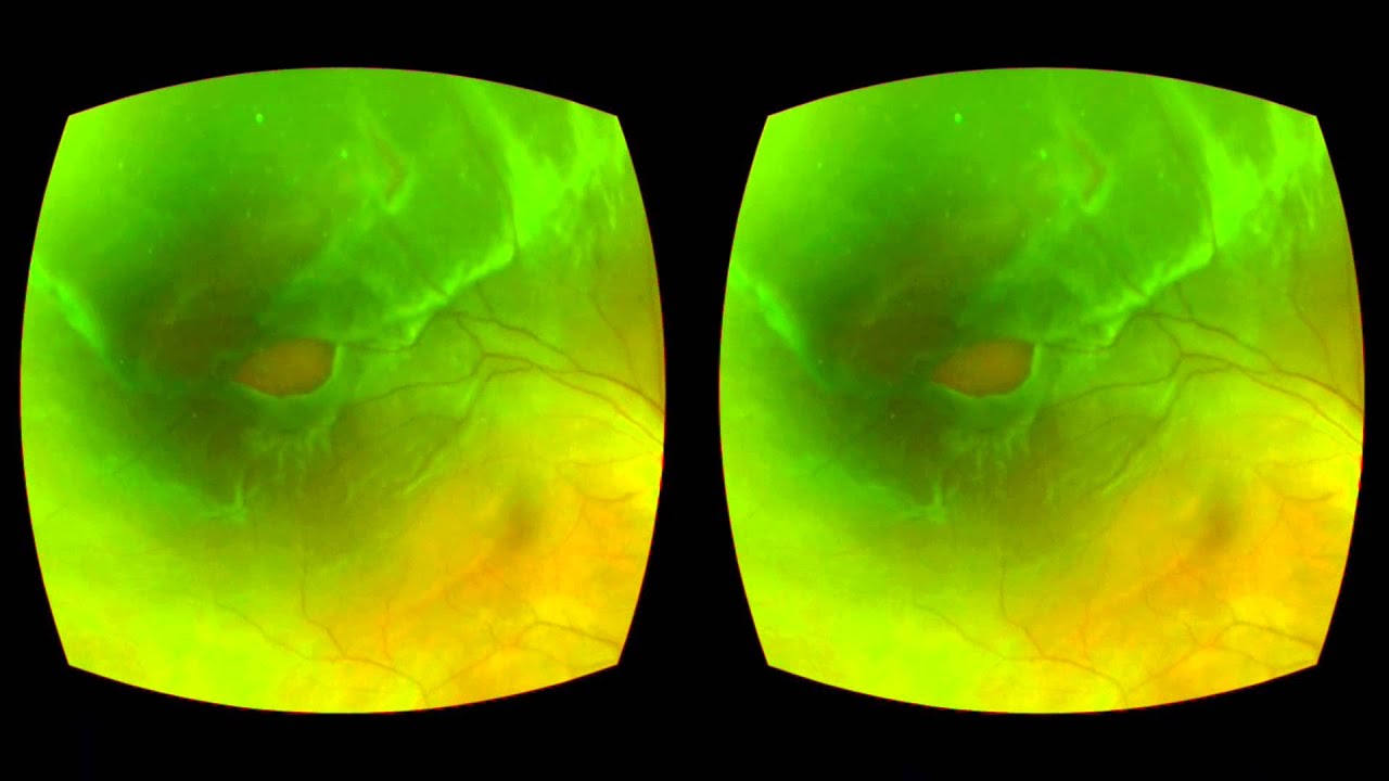 Retina in Oculus Gear VR - YouTube