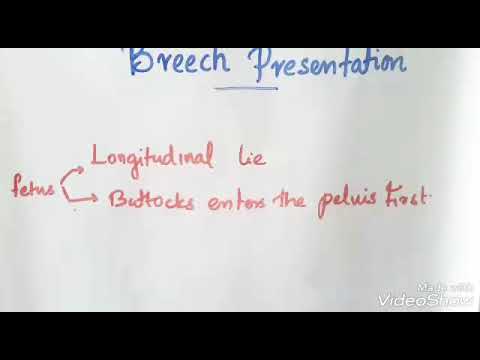 Mechanism of labour in breech Presentation - YouTube