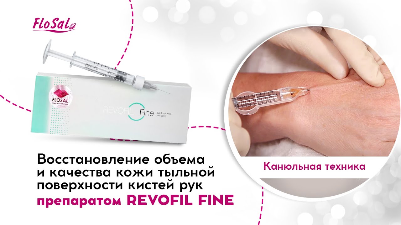 Восстановление объема и качества кожи кистей рук препаратом Revofil ...