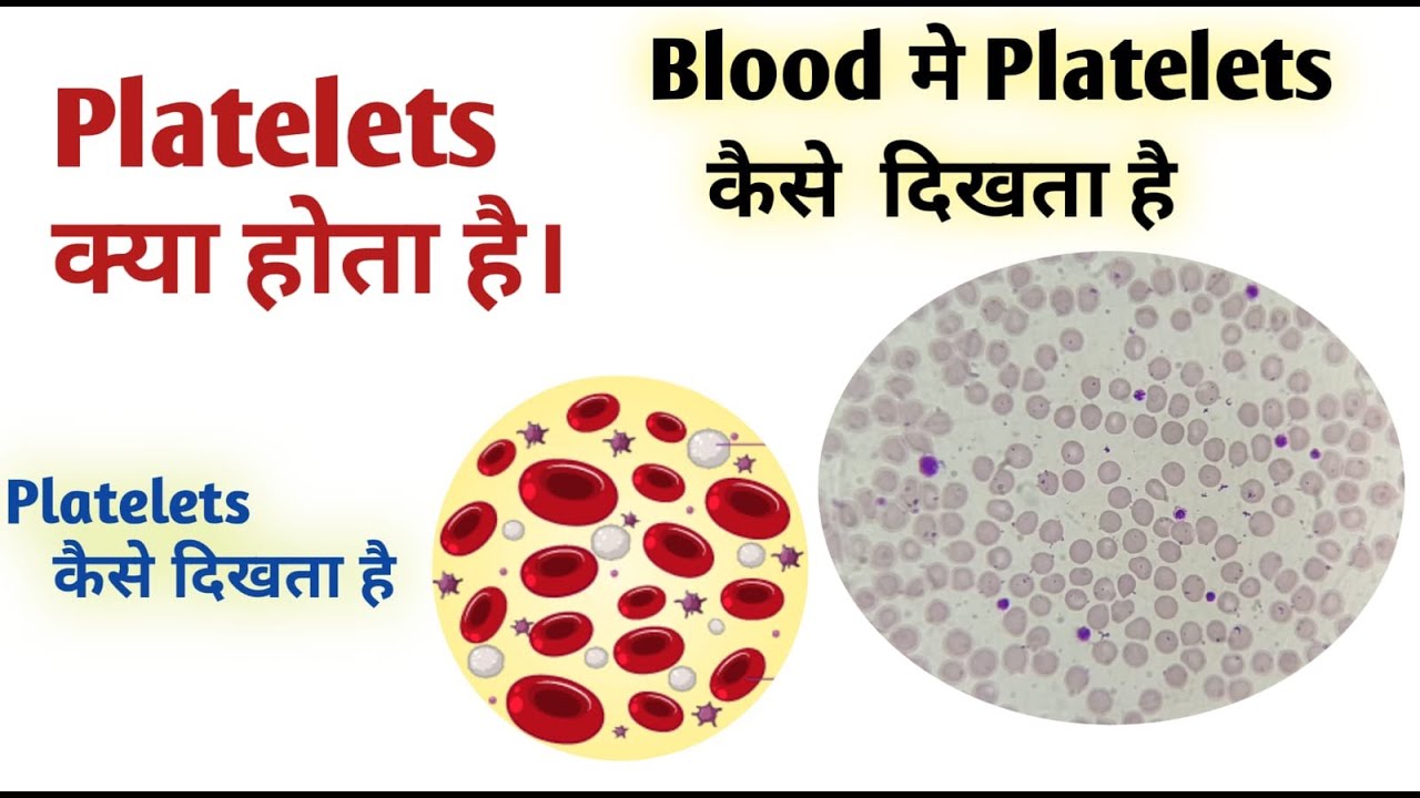 How to identify platelets I Platelet count in blood smear - YouTube