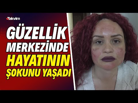 Yüzündeki leke için güzellik merkezine gitti, hayatının şokunu yaşadı