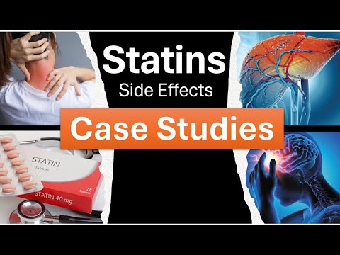 Statin Side Effects Case Studies - YouTube