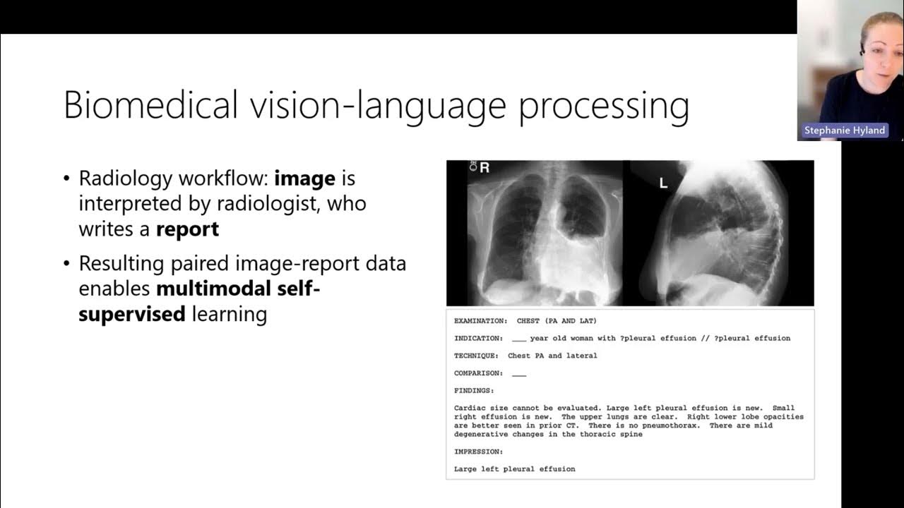 Learning to Exploit Temporal Structure for Biomedical Vision-Language Processing - YouTube