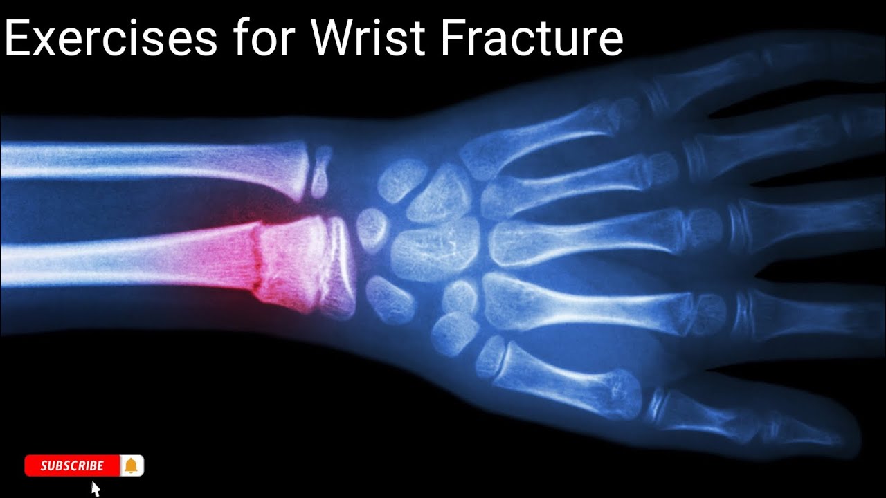 Exercise For Wrist# |Wrist Strength ing Exercise after Wrist Fracture ...