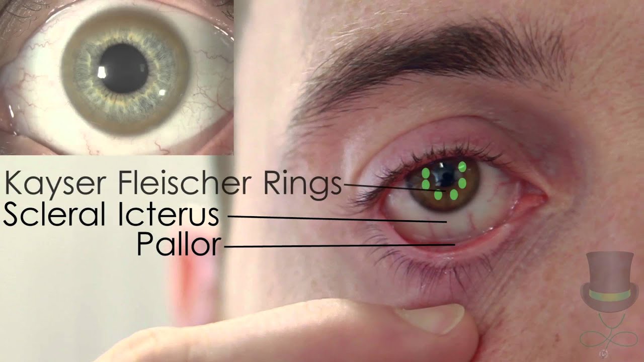 The Gastrointestinal Exam - YouTube