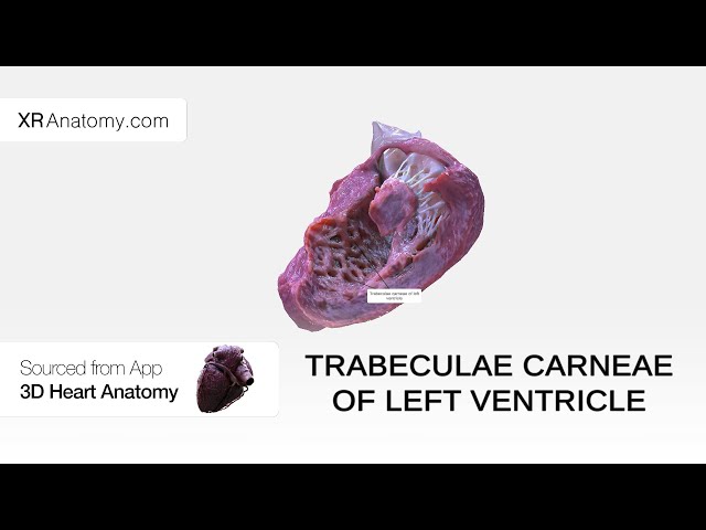 Tipos De Trabeculas Carneae