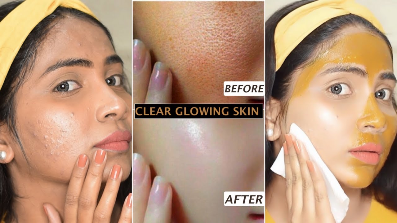 Skin Transformation-FACIALजैसे GLOW के लिए करे यह काम RADIANT SKIN के ...