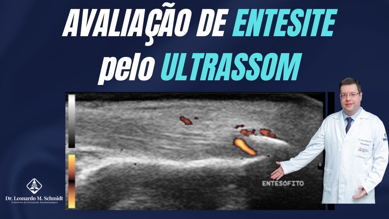 Saiba caracterizar ENTESITE ao Ultrassom - YouTube