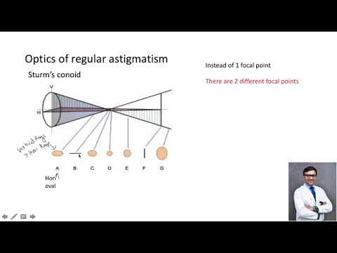 Sturm's conoid by Dr Vineet Sehgal