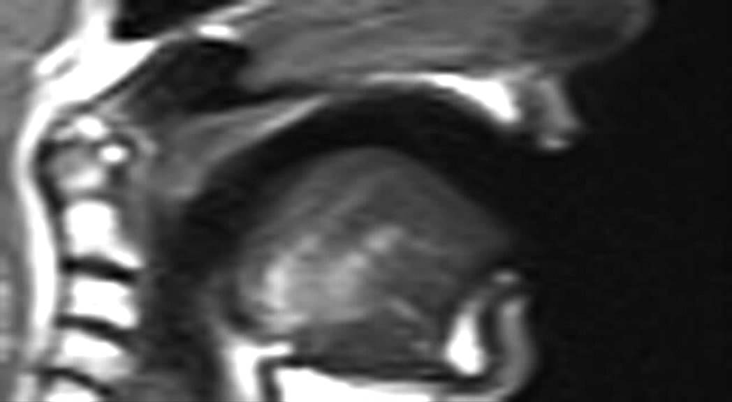 Ultrax MRI cardinal 3 - YouTube