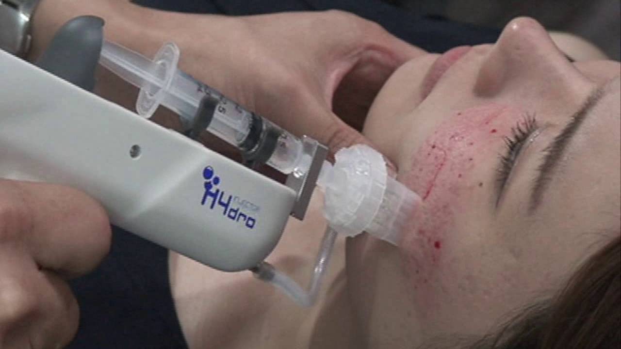 Hydro Injector treatment 2 - YouTube